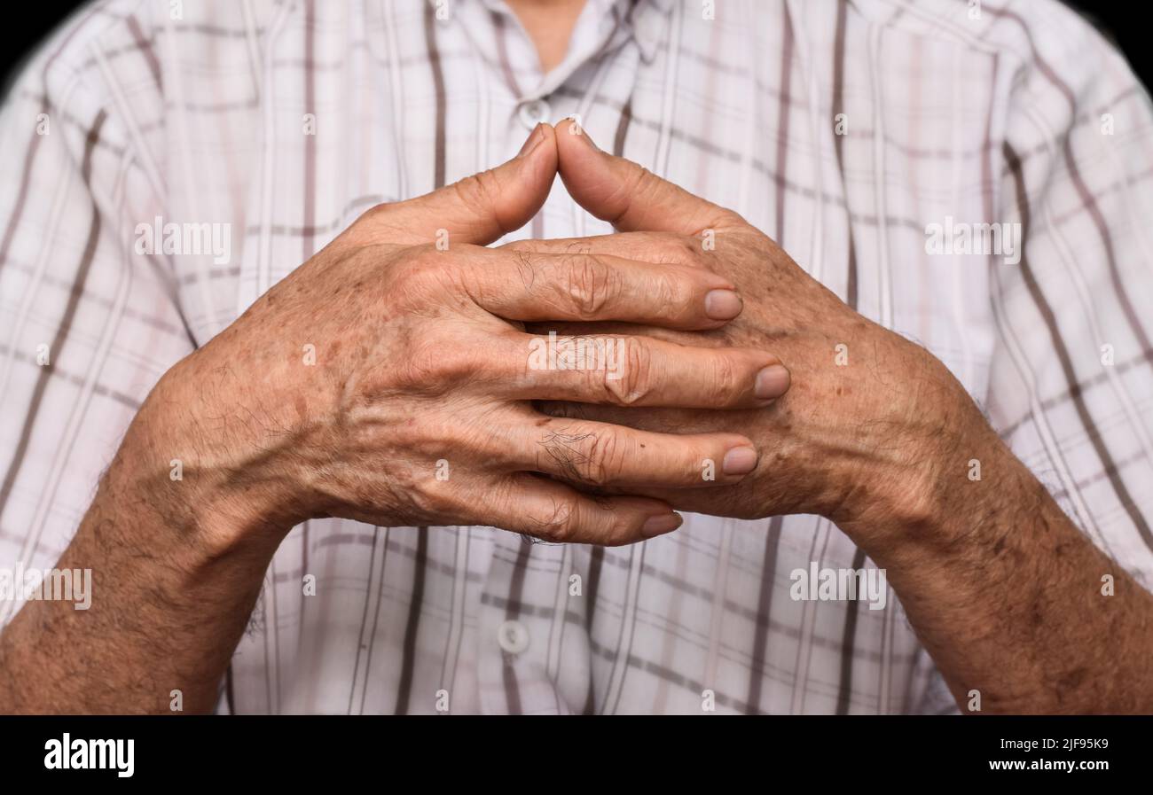 Hand of Southeast Asian elder man. Concept of rheumatoid arthritis ...