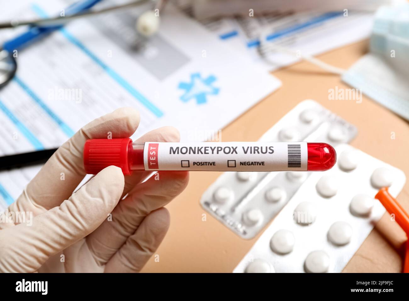 Female doctor with blood sample on beige background, closeup. Monkeypox ...