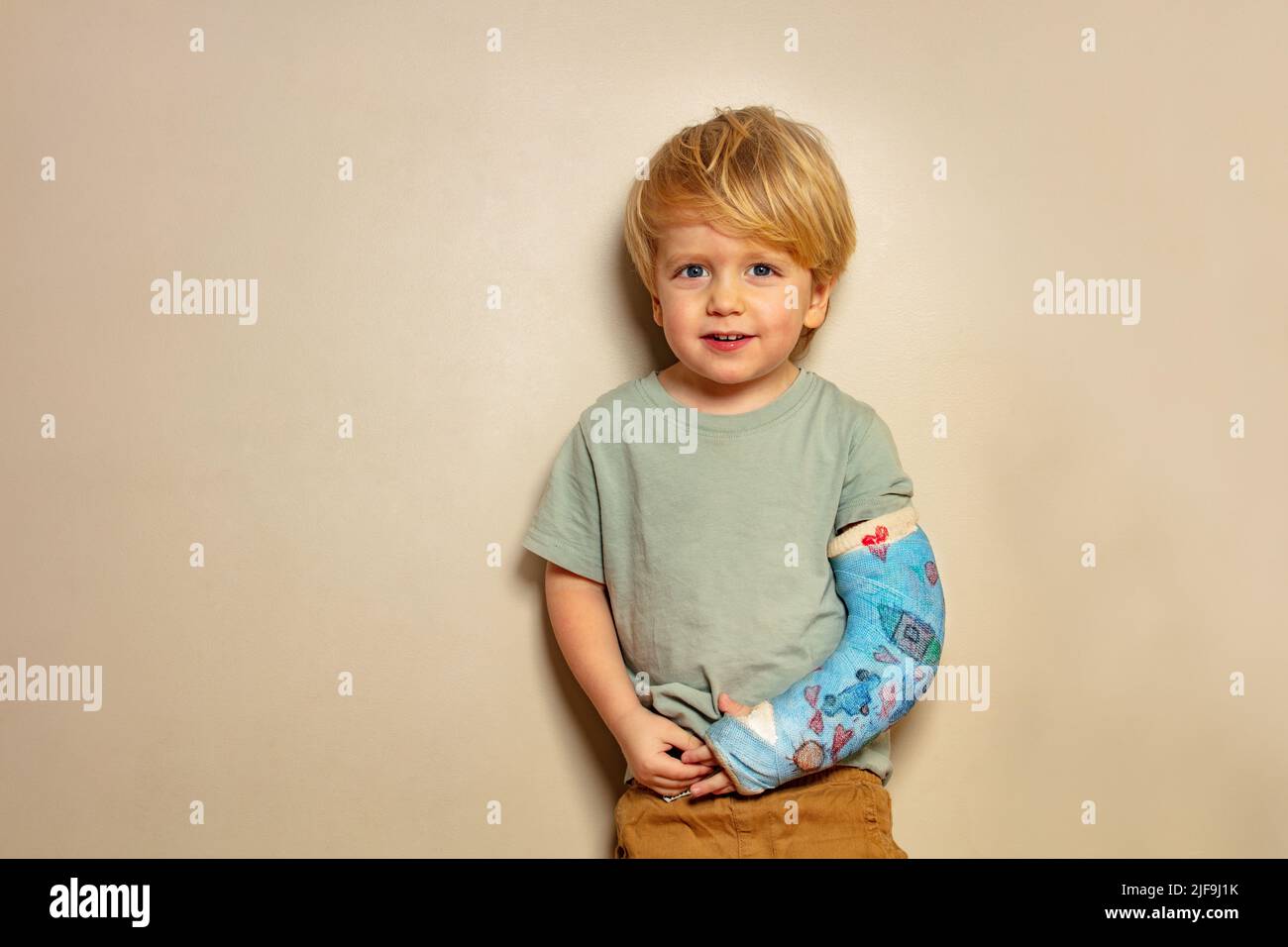 Boy positive despite broken hand in plaster cast after accident Stock ...