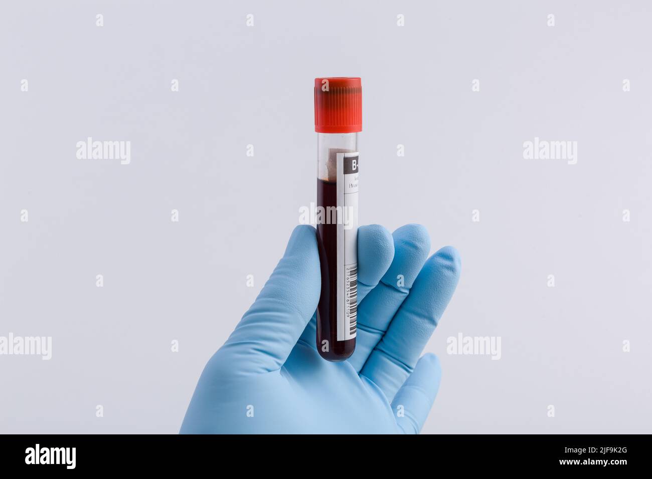 hand in medical gloves is handling a blood probe Stock Photo - Alamy