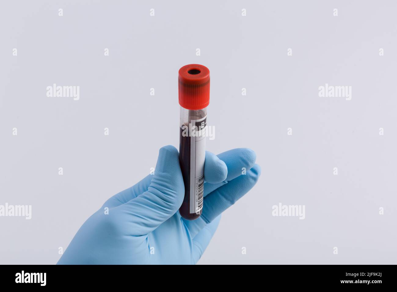 hand in medical gloves is handling a blood probe Stock Photo - Alamy