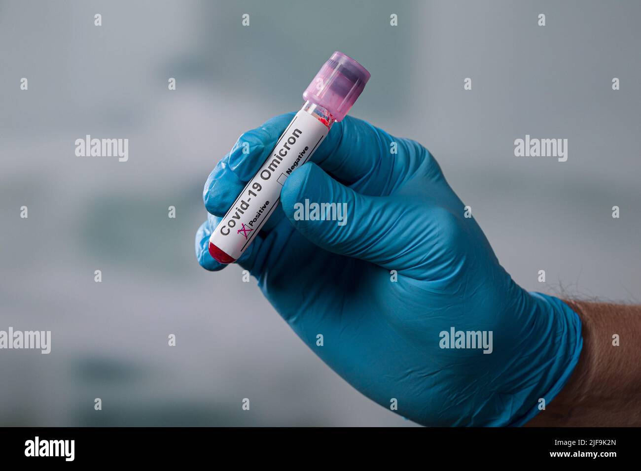 hand in blue glove holding a blood test tube with positive corona ...