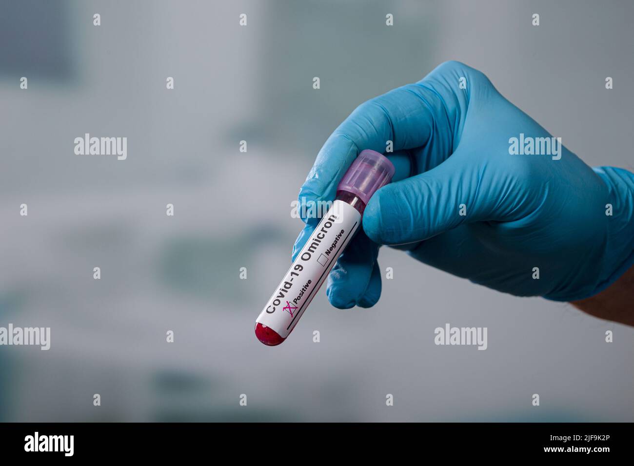 hand in blue glove holding a blood test tube with positive corona ...