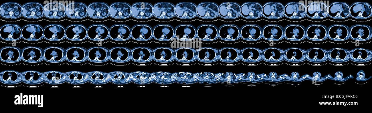 Magnetic Resonance Image (MRI) of chest organs Stock Photo - Alamy