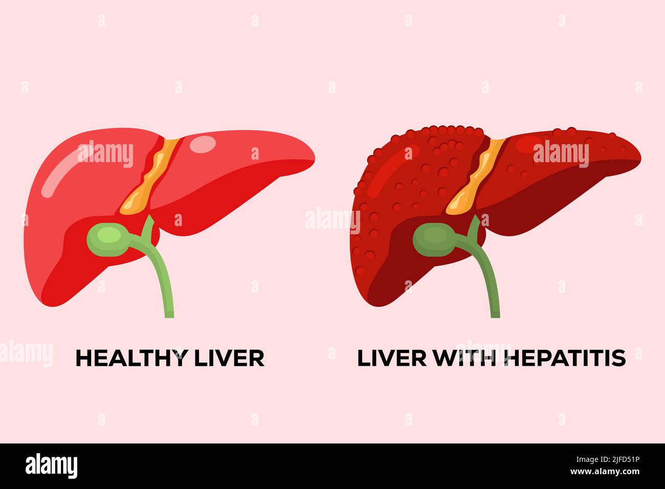 Diagnose liver Stock Vector Images - Alamy