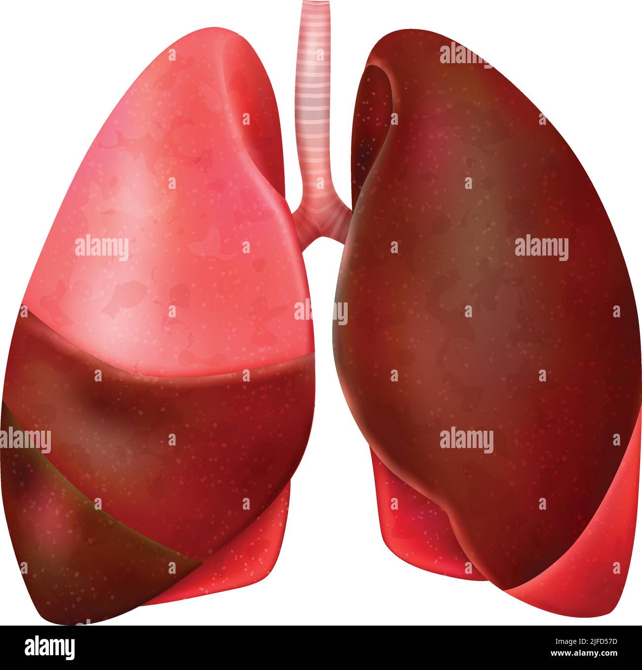 Realistic world pneumonia day composition with isolated image of ...