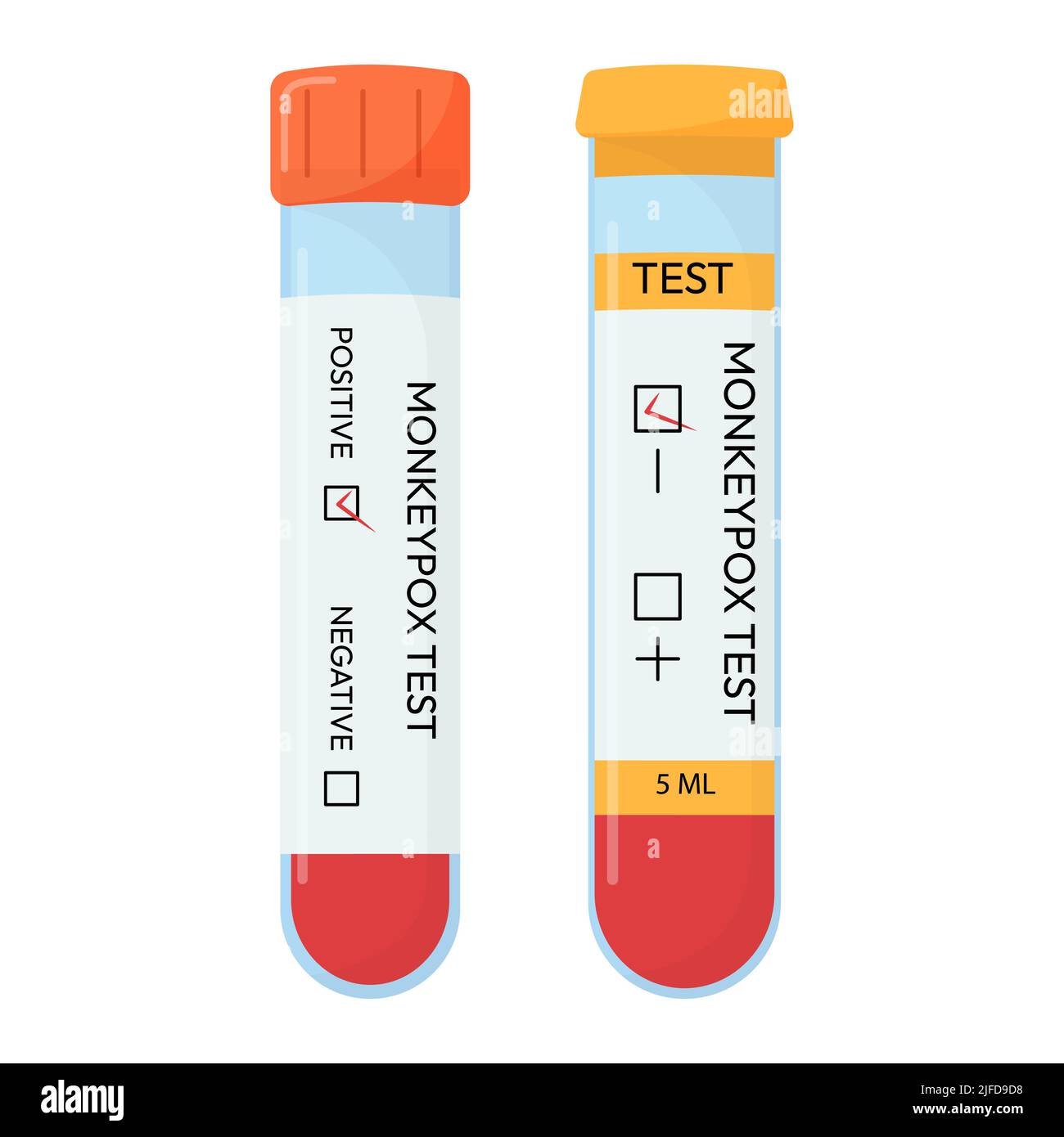 Blood sample tube for Monkeypox virus test. Positive or negative test ...