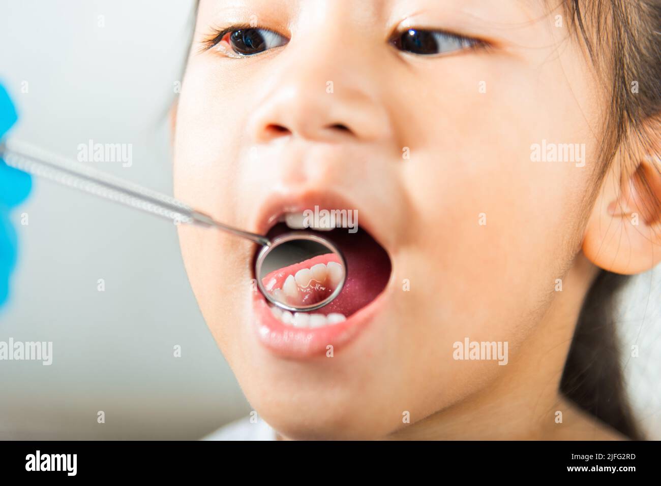 Dental kid health examination. Asian dentist making examination procedure for cute little girl ...