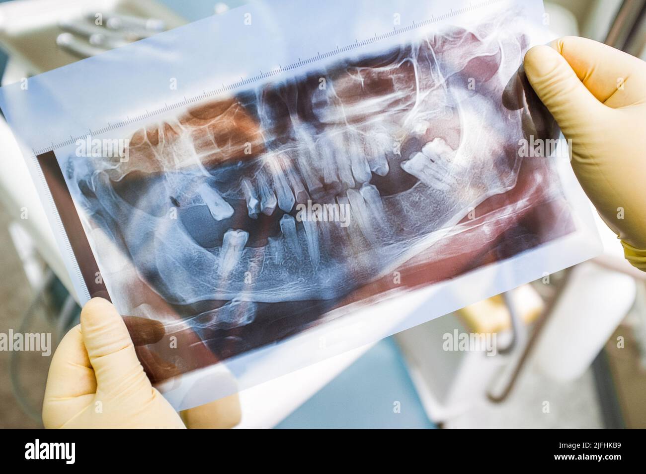 Panoramic x ray hi-res stock photography and images - Alamy