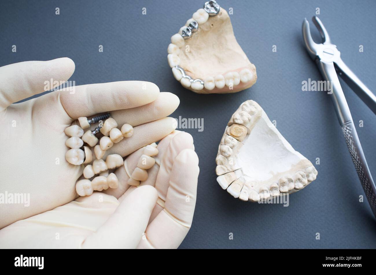 Jaw layout modeling top view Stock Photo - Alamy