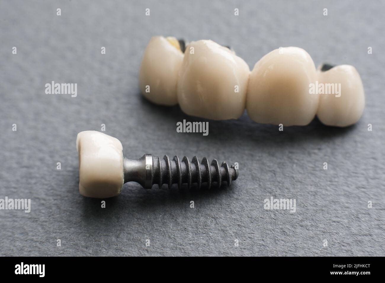 Dental crown hi-res stock photography and images - Alamy