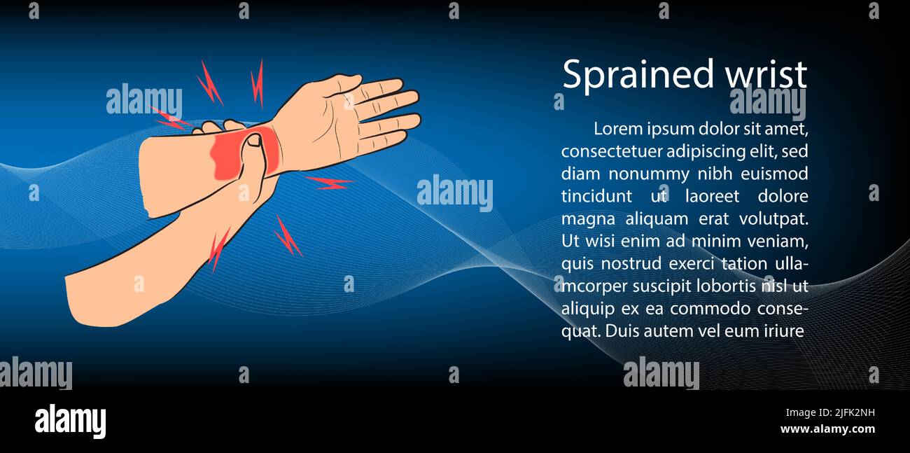 Graphics Design paper brochure, Broken or Sprained Wrist Diagram vector ...