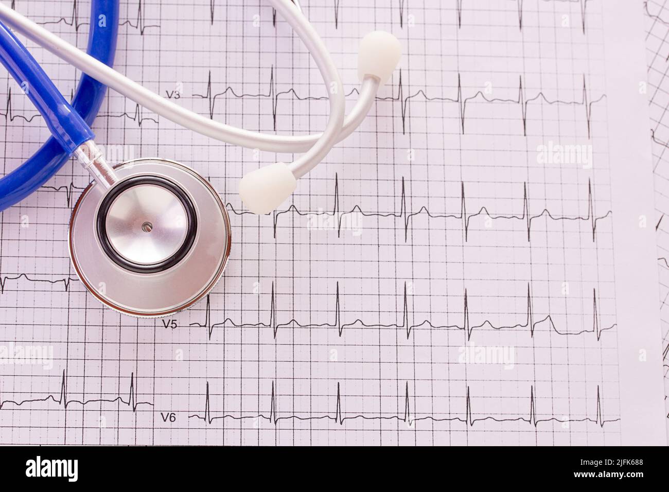 Blue stethoscope and cardiogram pulse trace concept for cardiovascular ...