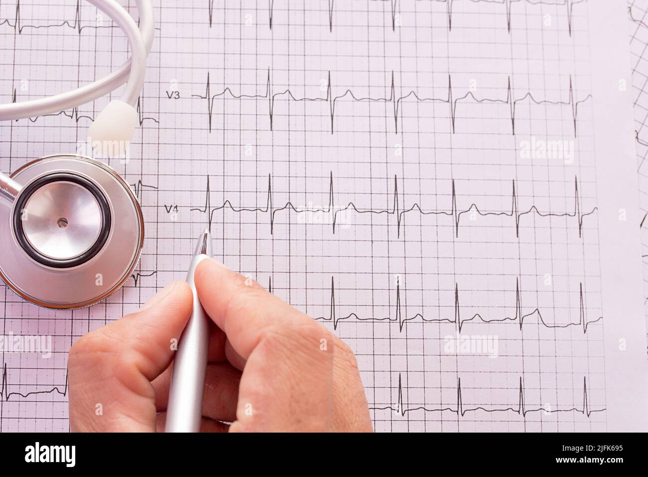 Blue stethoscope and cardiogram pulse trace concept for cardiovascular ...