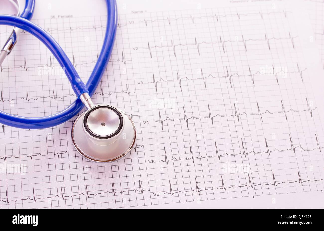 Blue stethoscope and cardiogram pulse trace concept for cardiovascular ...