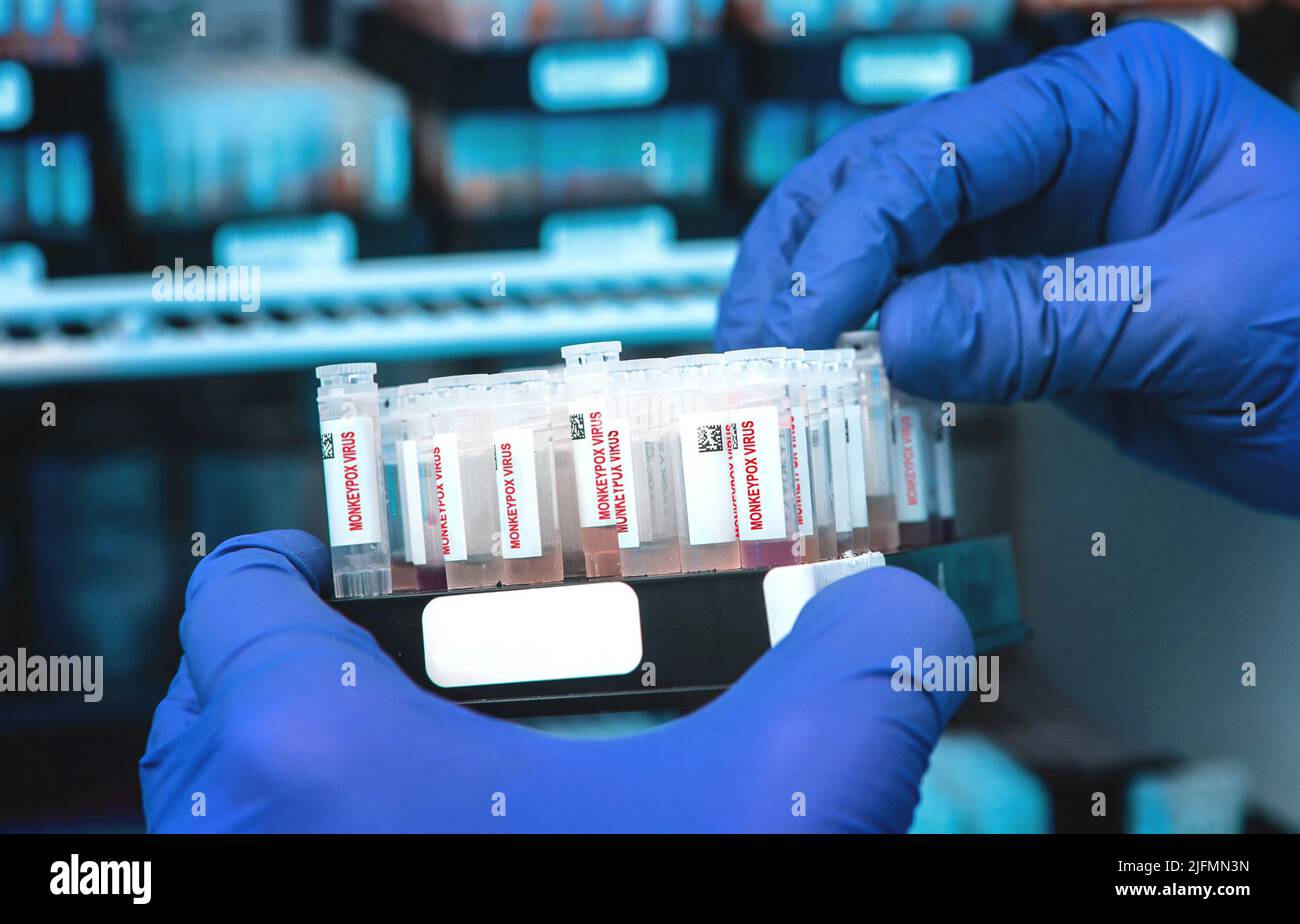 Monkeypox virus test tubes in hands with blue gloves Stock Photo - Alamy