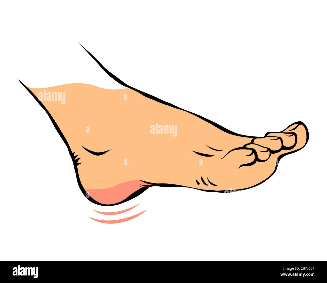 Line sketch female leg with problematic pain. Sore heel. Orthopedic ...