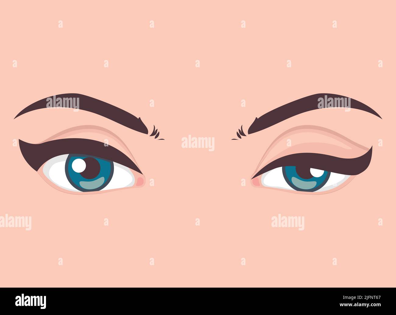 Ptosis of the upper eyelid, optical problem with eye, medical vector ...