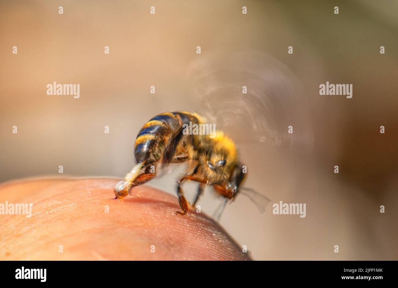 Bee sting skin hi-res stock photography and images - Alamy