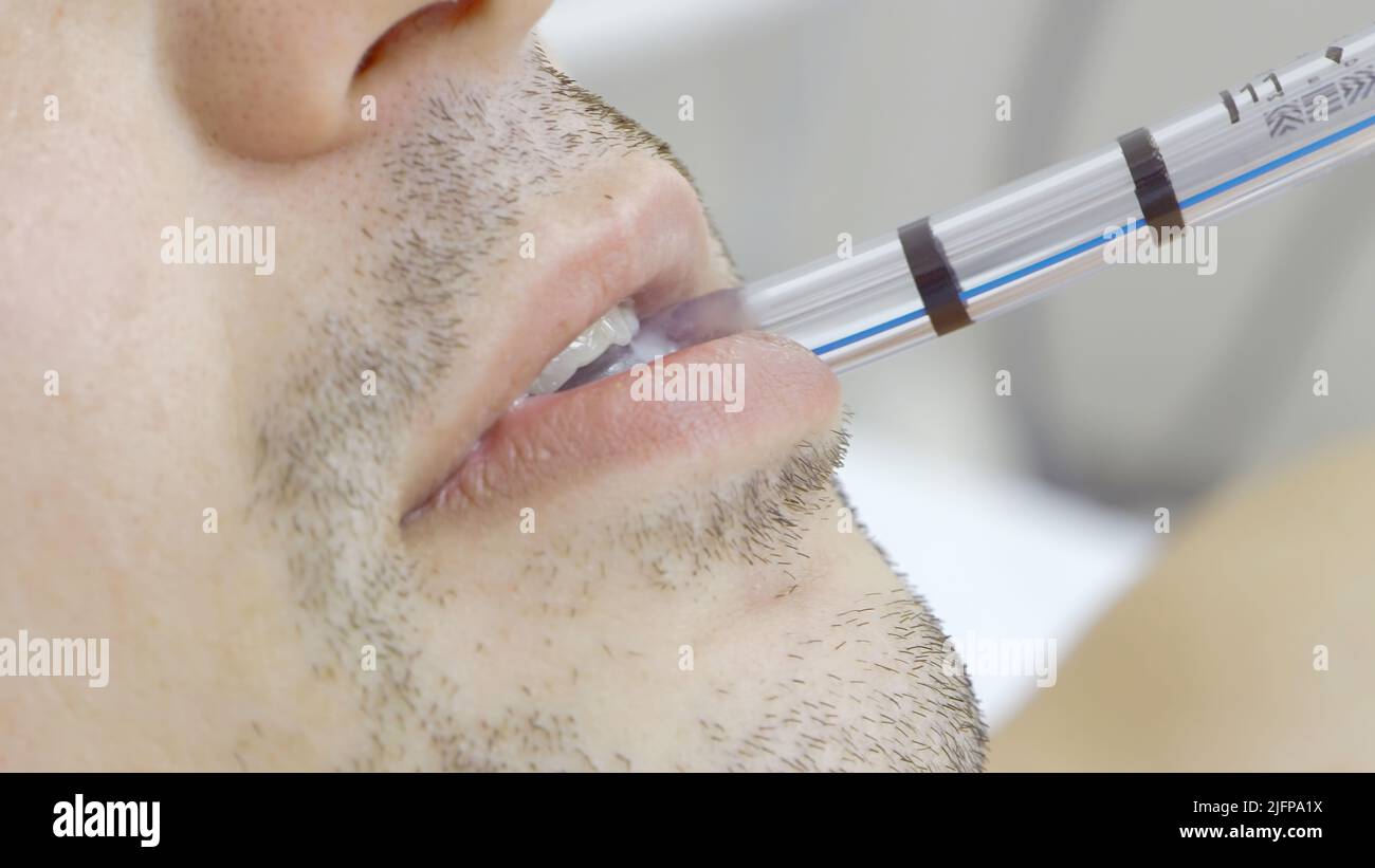 Caucasian man in coma at the hospital room. Action. Sick man in ...