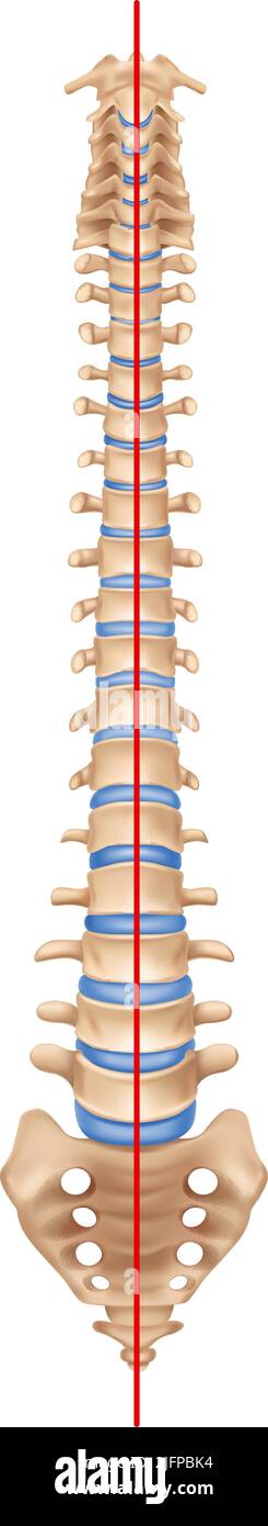 Human spine anatomy scoliosis composition with isolated image of normal ...