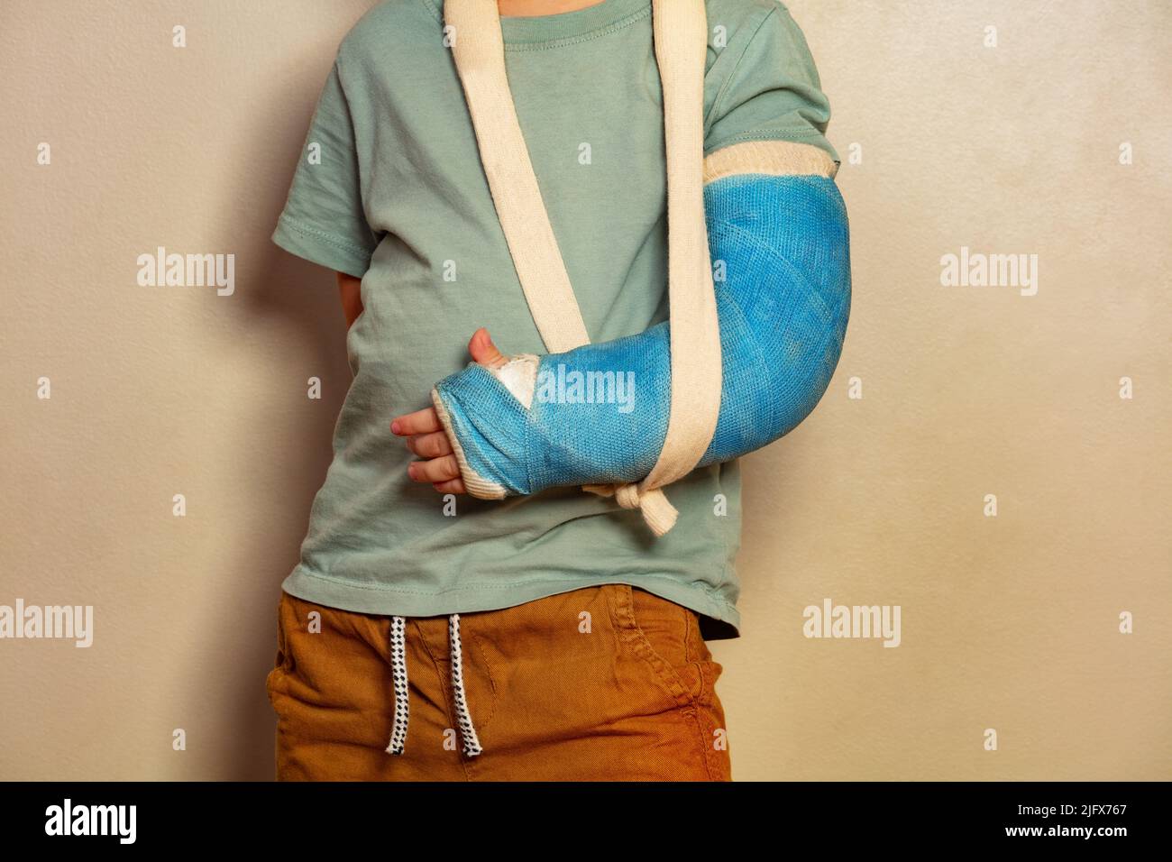 Close-up of a little boy broken hand in cast Stock Photo - Alamy
