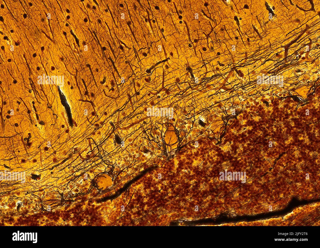 Brain, light micrograph Stock Photo - Alamy