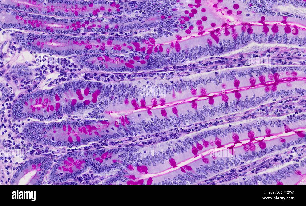 Small intestine, light micrograph Stock Photo - Alamy