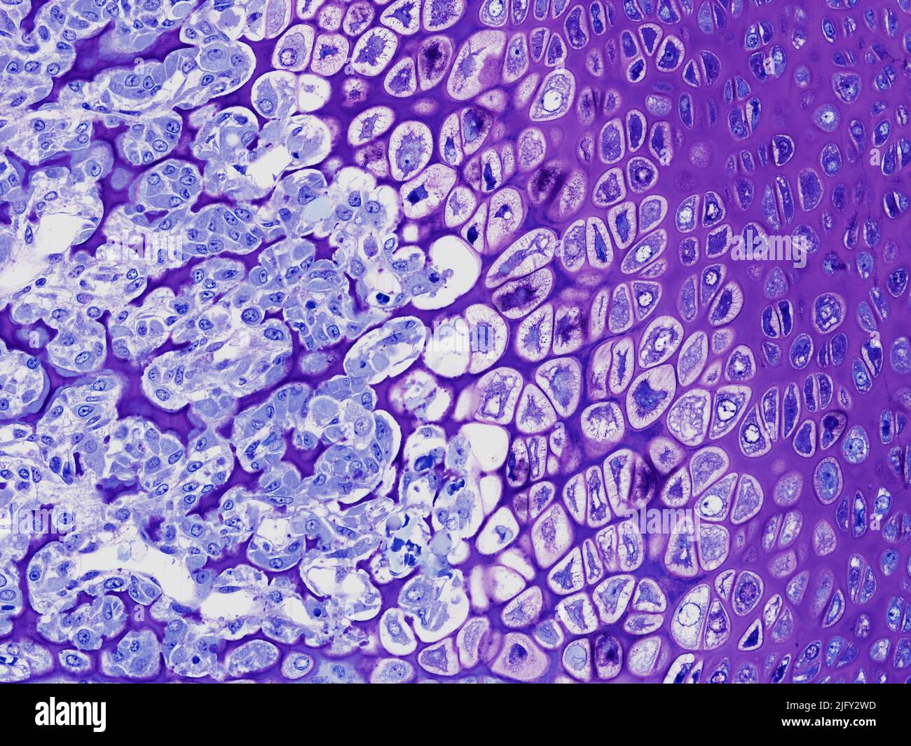 Growth plate, light micrograph Stock Photo - Alamy