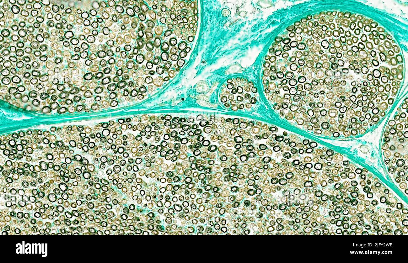 Nerve tissue, light micrograph Stock Photo - Alamy