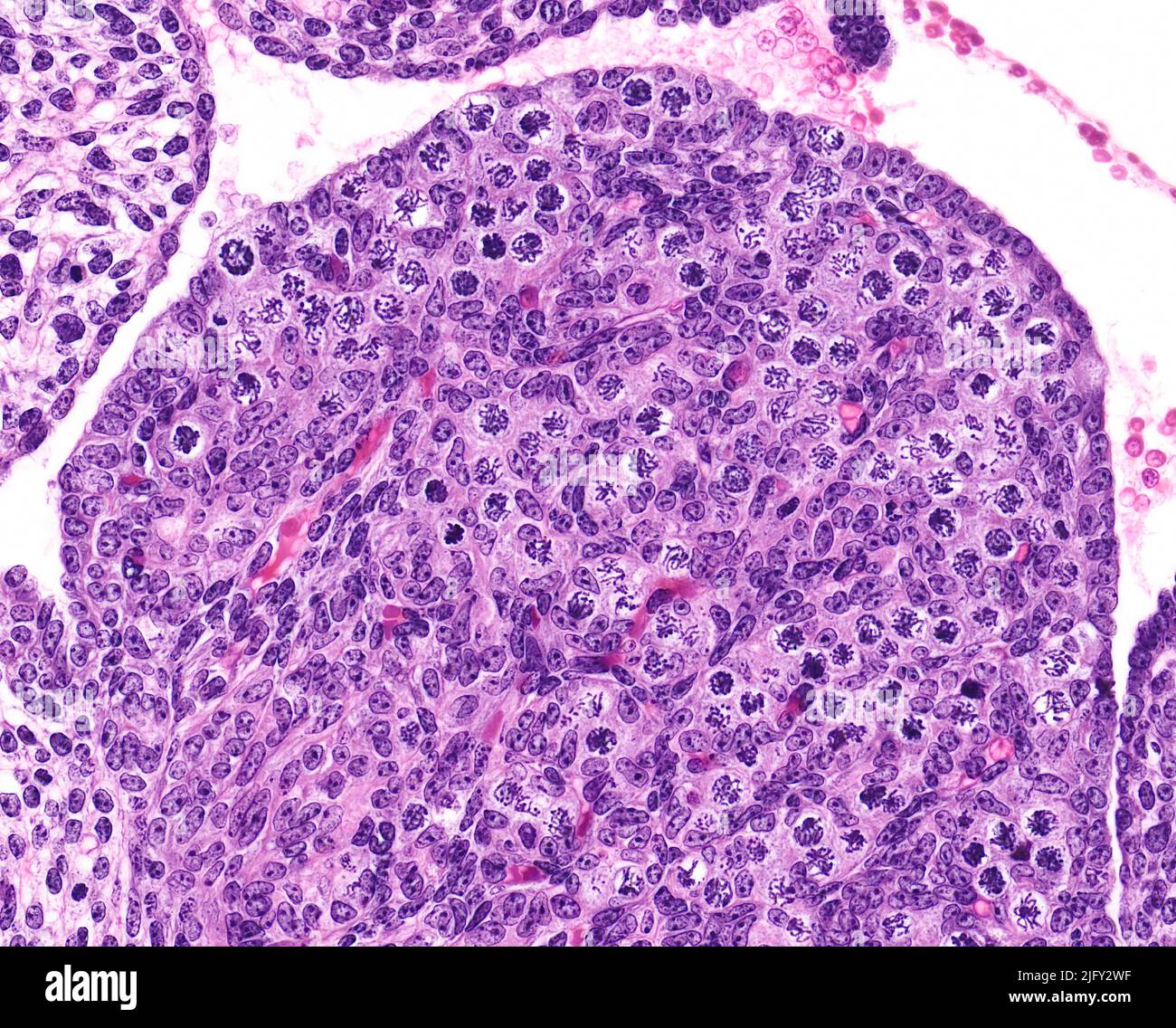 Foetal ovary, light micrograph Stock Photo - Alamy