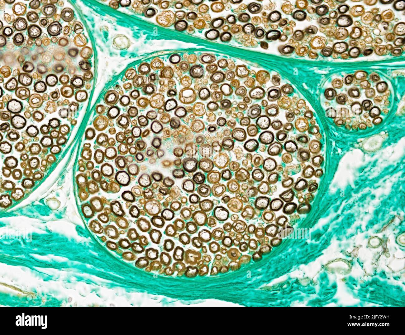 Peripheral nerve, light micrograph Stock Photo - Alamy