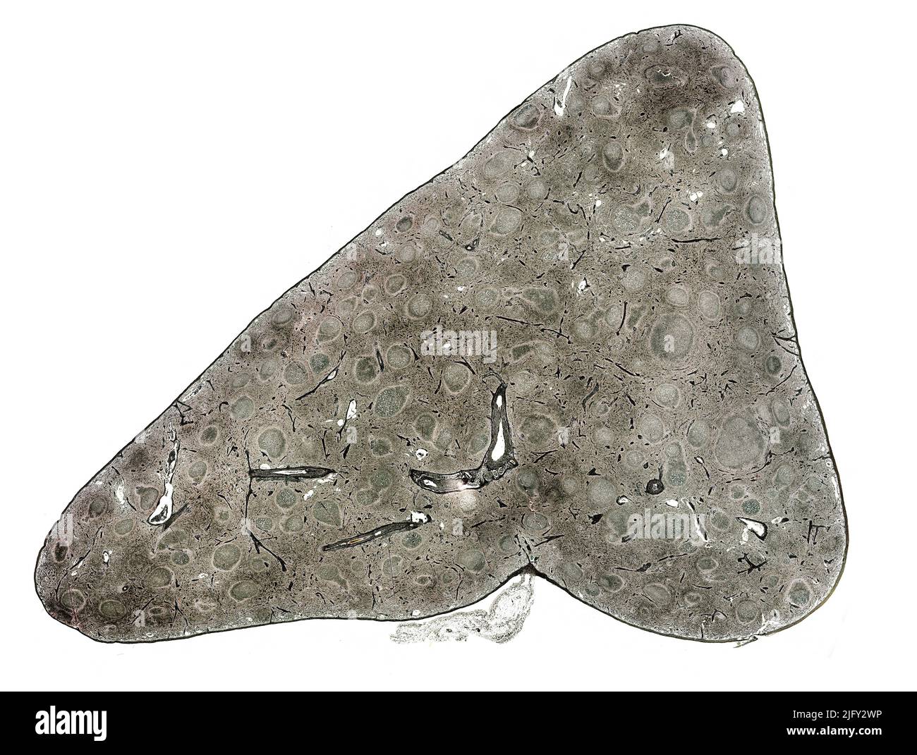 Spleen, light micrograph Stock Photo - Alamy