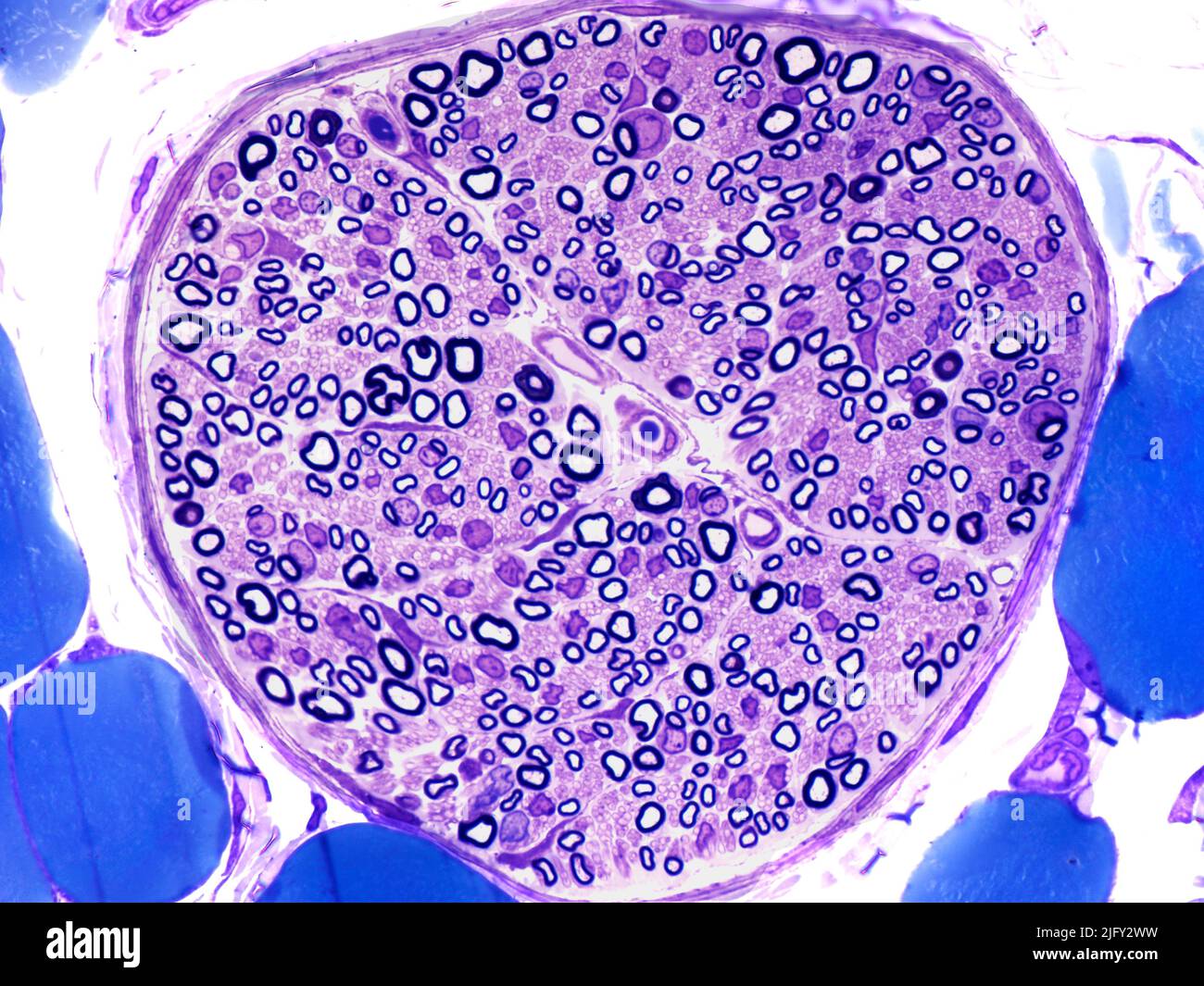 Nerve tissue, light micrograph Stock Photo - Alamy