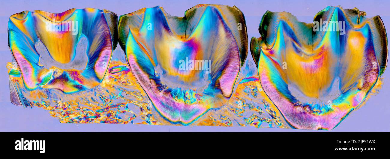 Teeth, light micrograph Stock Photo - Alamy