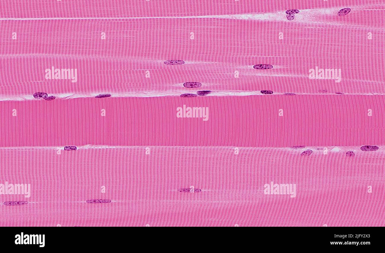 Skeletal muscle, light micrograph Stock Photo - Alamy