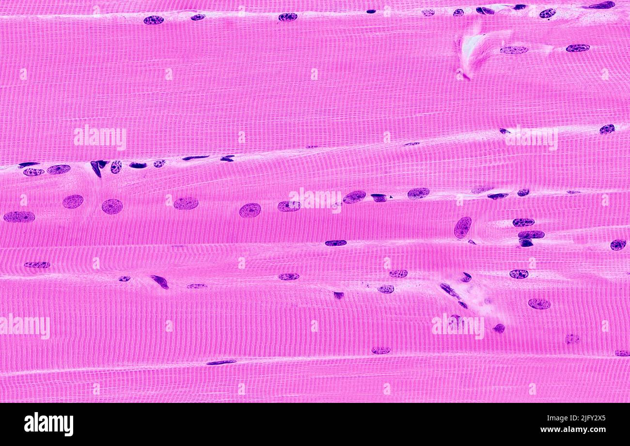 Skeletal muscle, light micrograph Stock Photo - Alamy