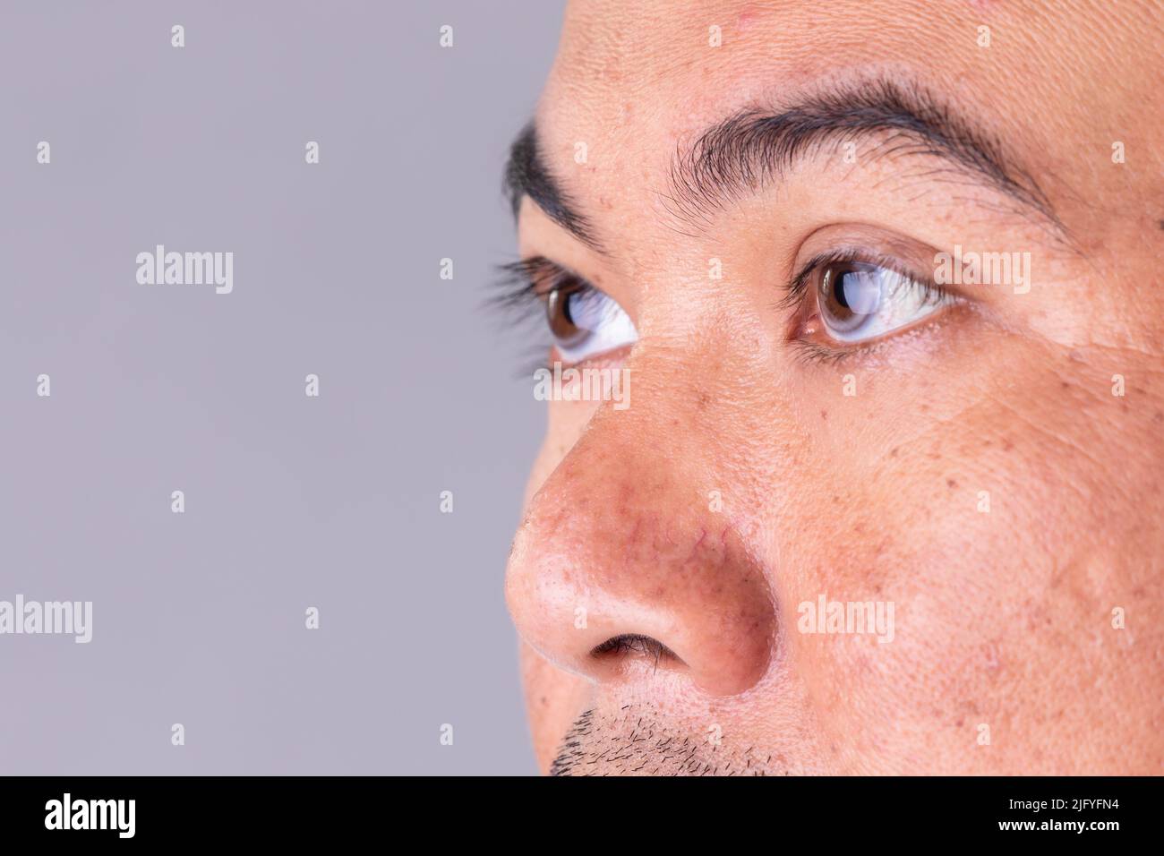 Macro face skin of asian man to show many skin problem. Men skin care ...