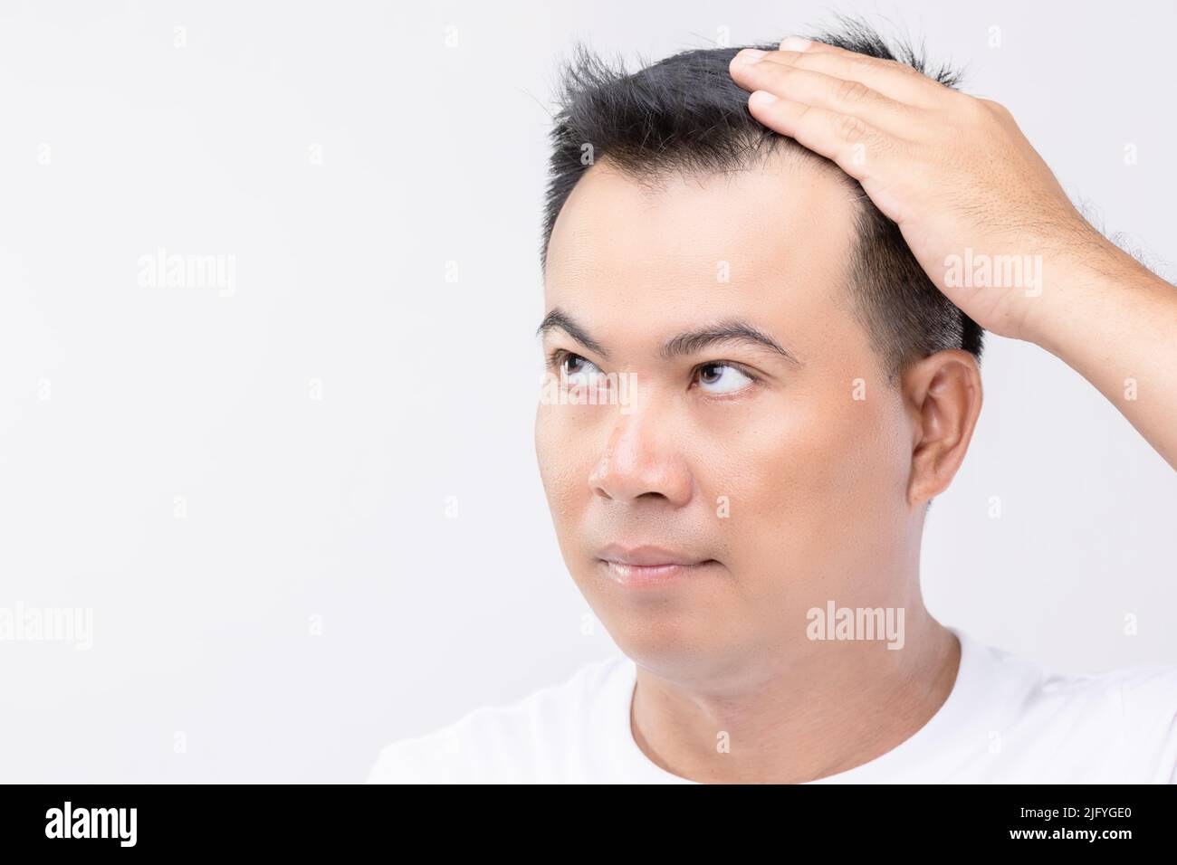 Portrait Asian man with worry feeling and touching on his head to show ...