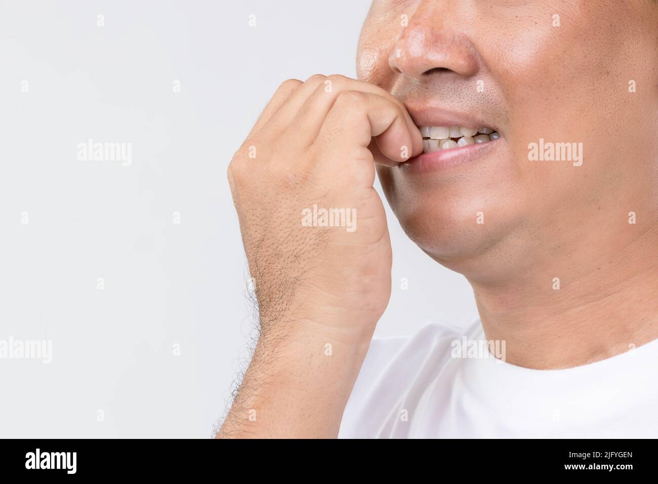 Nail Biting (Onychophagia) concept : Portrait people biting his nail ...