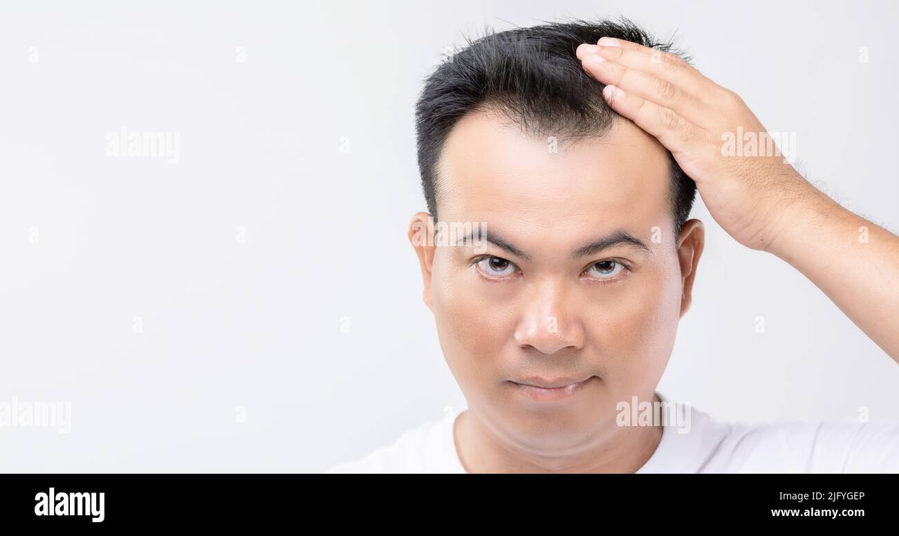Portrait Asian man with worry feeling and touching on his head to show ...