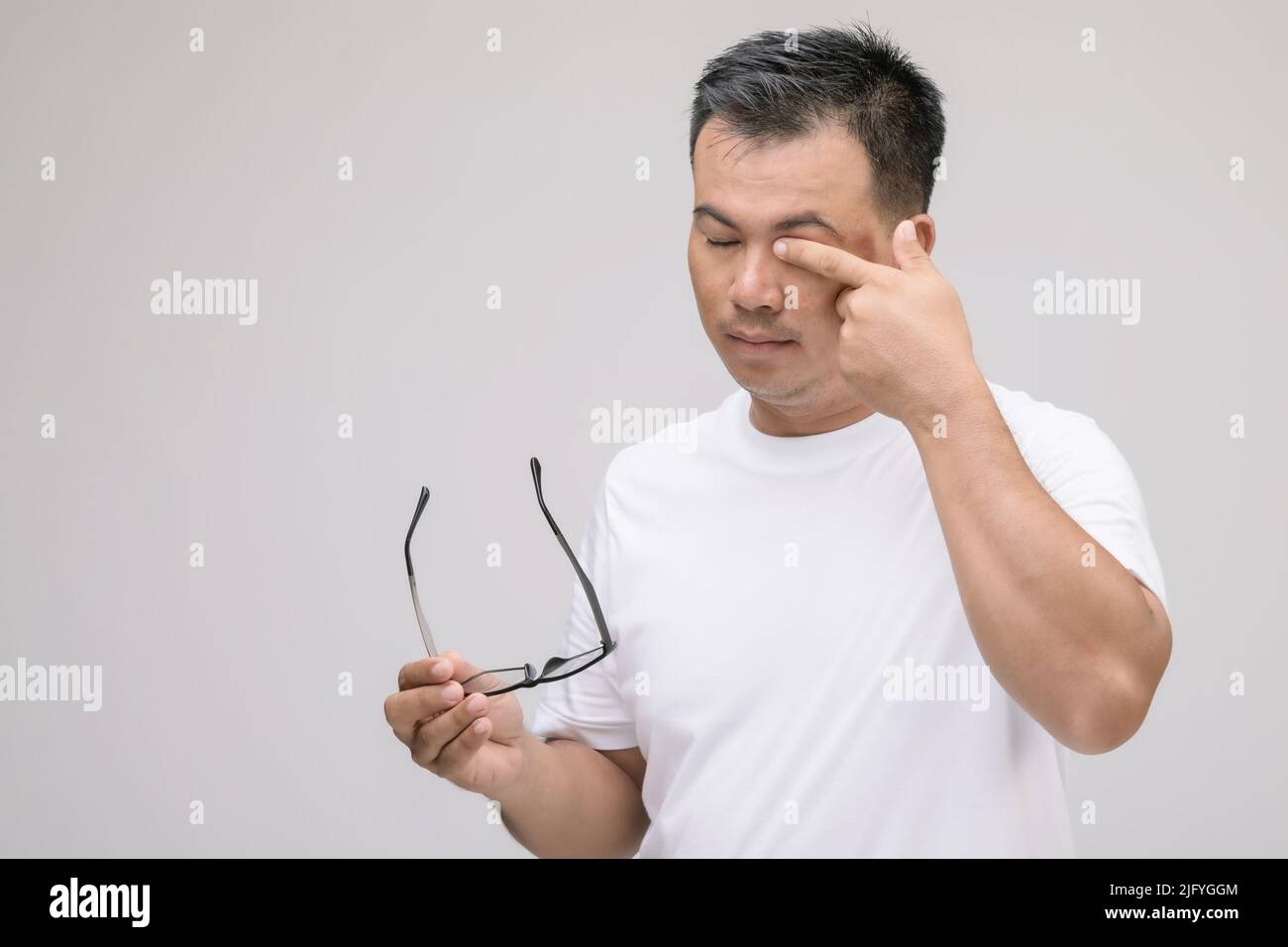 Eye irritation concept : Portrait of Asian man in posture of eye tired ...
