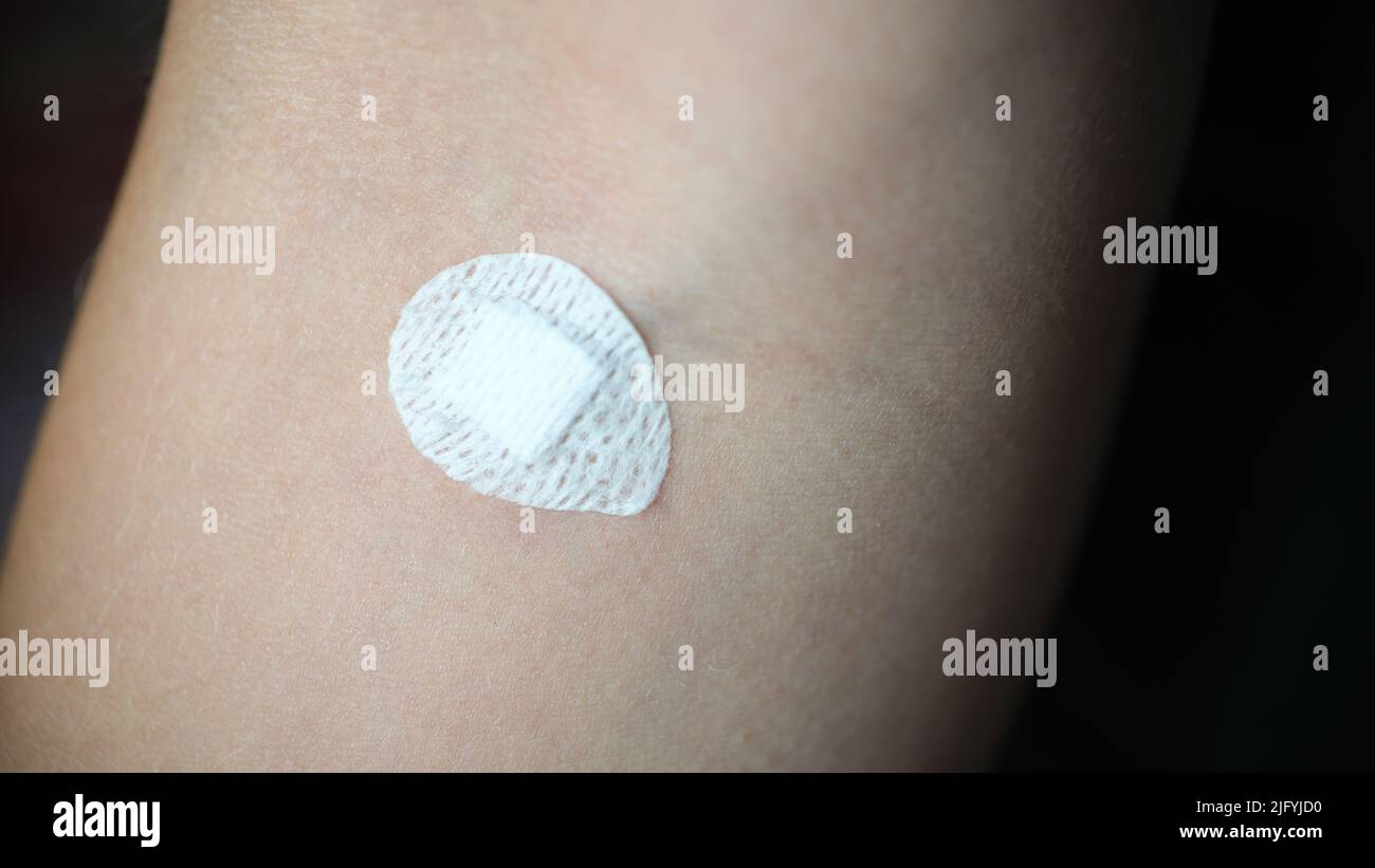 Small round patch stuck in place intravenous injection on forearm ...