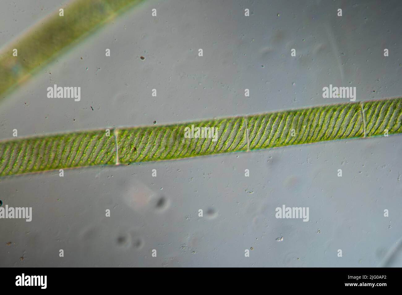 Spirogyra Under Compound Microscope