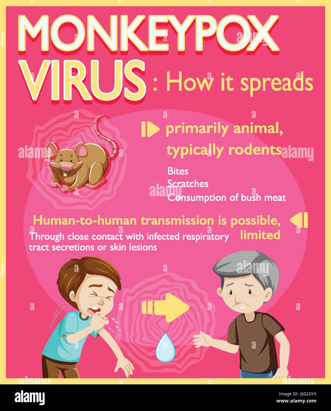 Monkeypox virus symptoms infographic illustration Stock Vector Image ...