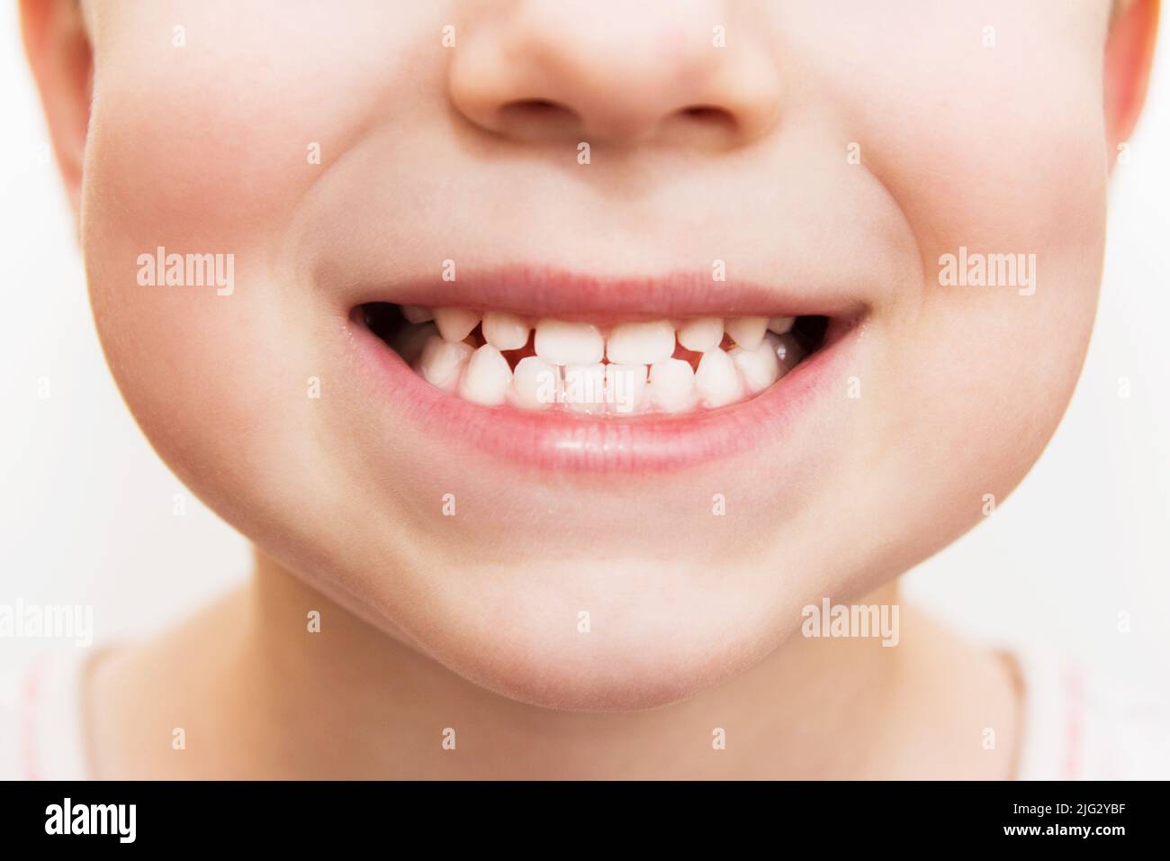 baby smile close. child teeth on a white isolated background Stock ...