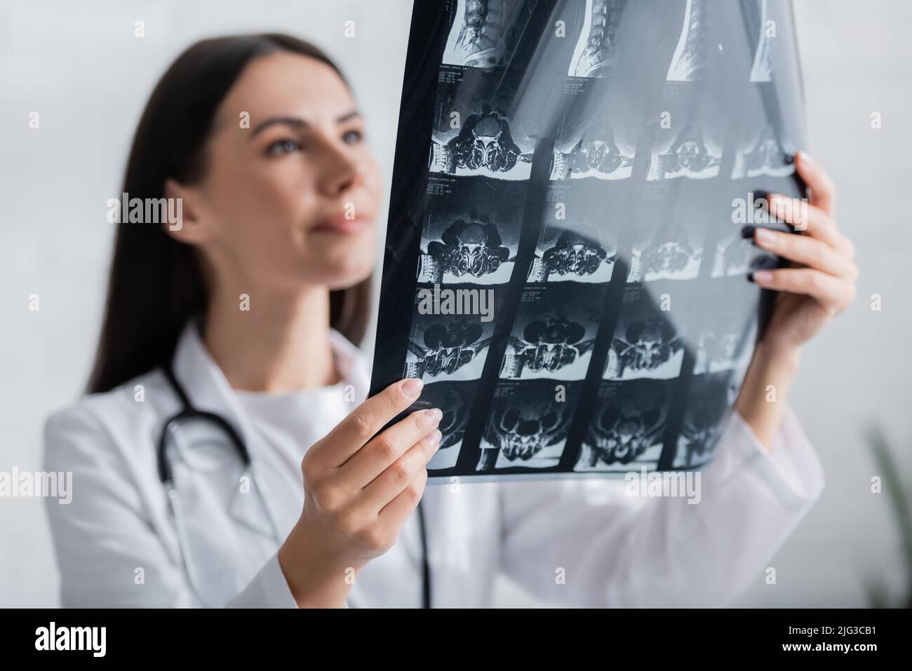 Blurred doctor mri hospital hi-res stock photography and images - Alamy
