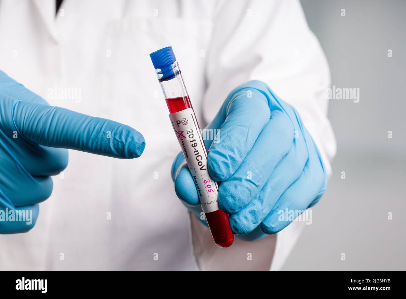 hand in medical gloves handling a blood probe with covid markers Stock ...