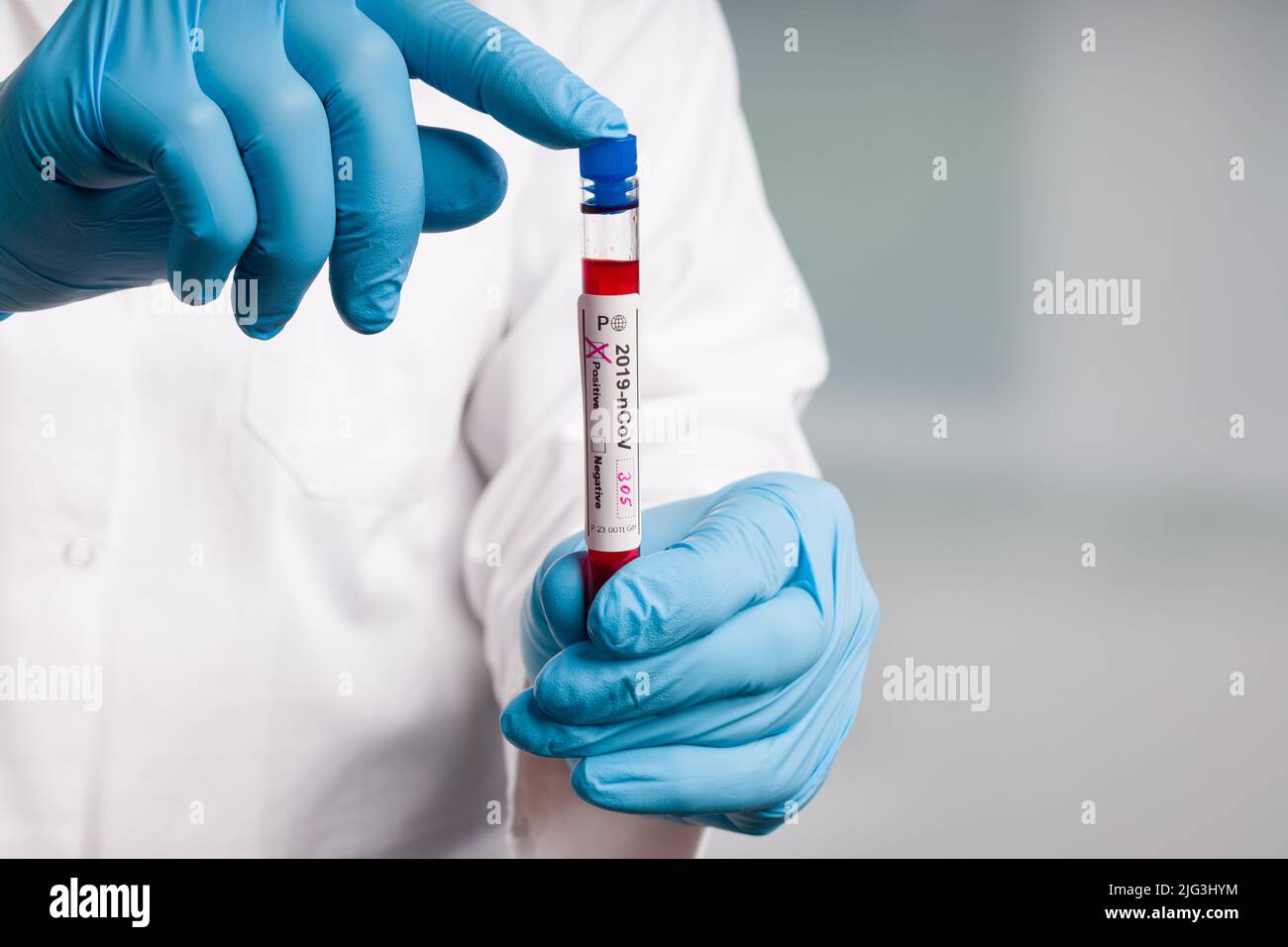 hand in medical gloves handling a blood probe with covid markers Stock ...