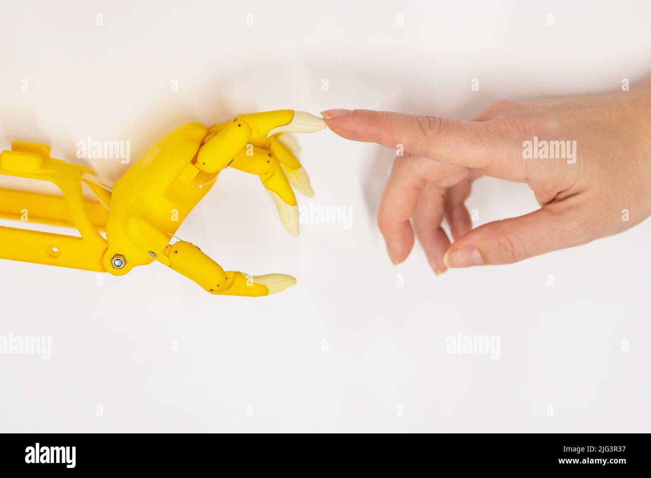 Prosthetic hand child hi-res stock photography and images - Alamy